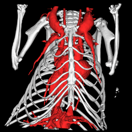 Imalytics Preclinical - MediLumine