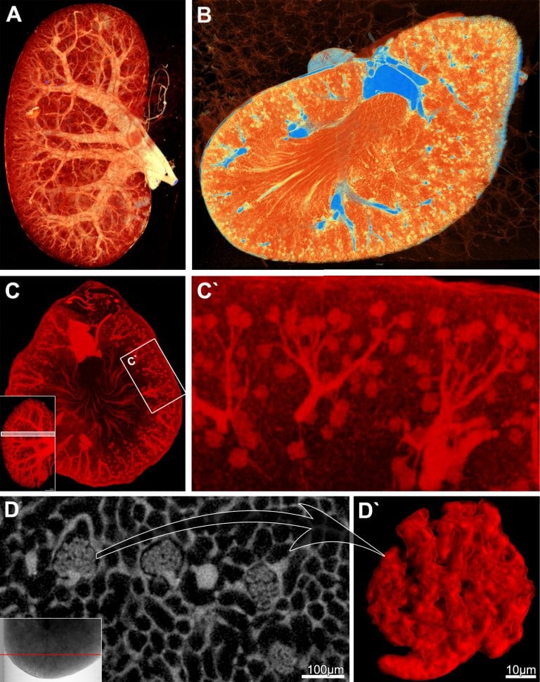 New Ex Vivo Angiogenesis Assessment Technique - MediLumine