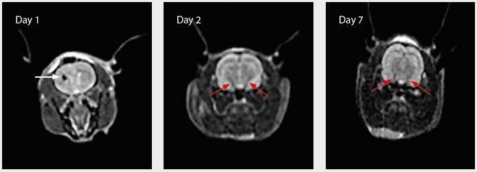 FeraSpin™ T - MediLumine
