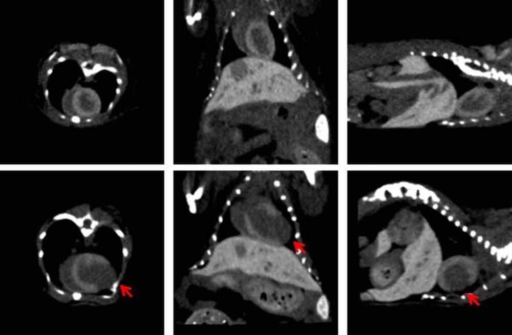 ExiTron™ MyoC 8000 - MediLumine