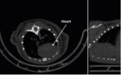 ExiTron™ ultra 18000 - MediLumine