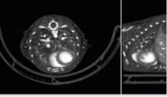 ExiTron™ ultra 18000 - MediLumine