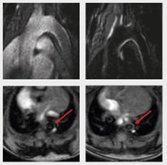 GadoSpin™ F - MediLumine