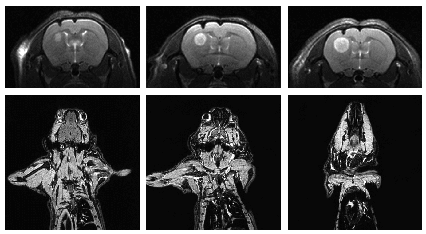 GadoSpin™ M - MediLumine