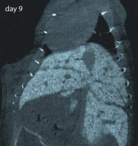 ExiTron™ nano 6000 - MediLumine