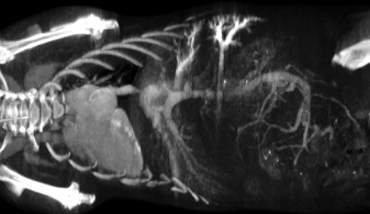 ExiTron™ P - MediLumine