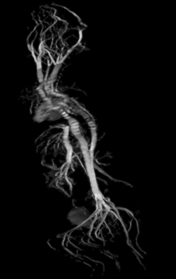 FeraSpin™ XXL - MediLumine