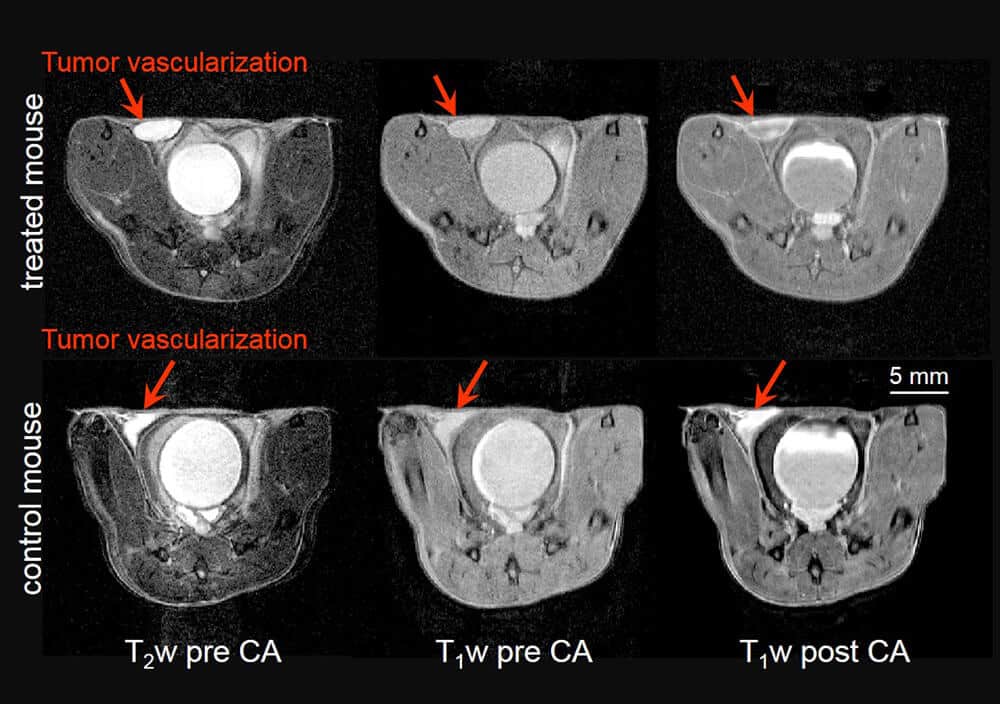 GadoSpin™ D - MediLumine