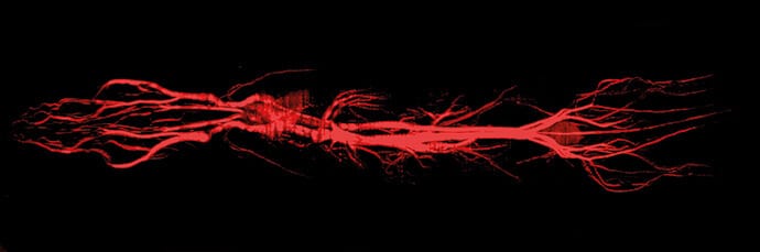 GadoSpin™ P - MediLumine