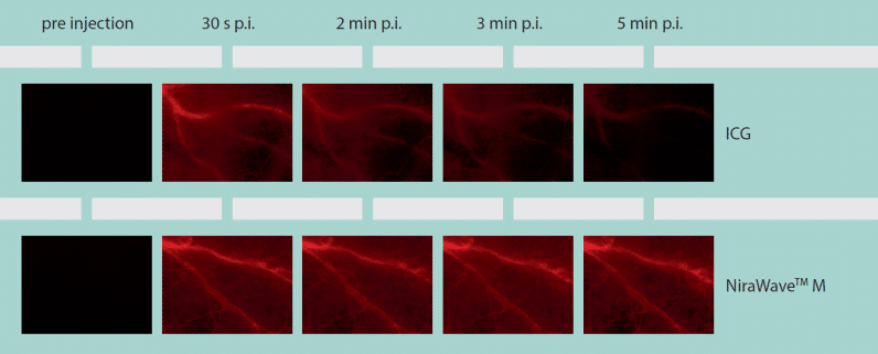 NiraWave™ M - MediLumine