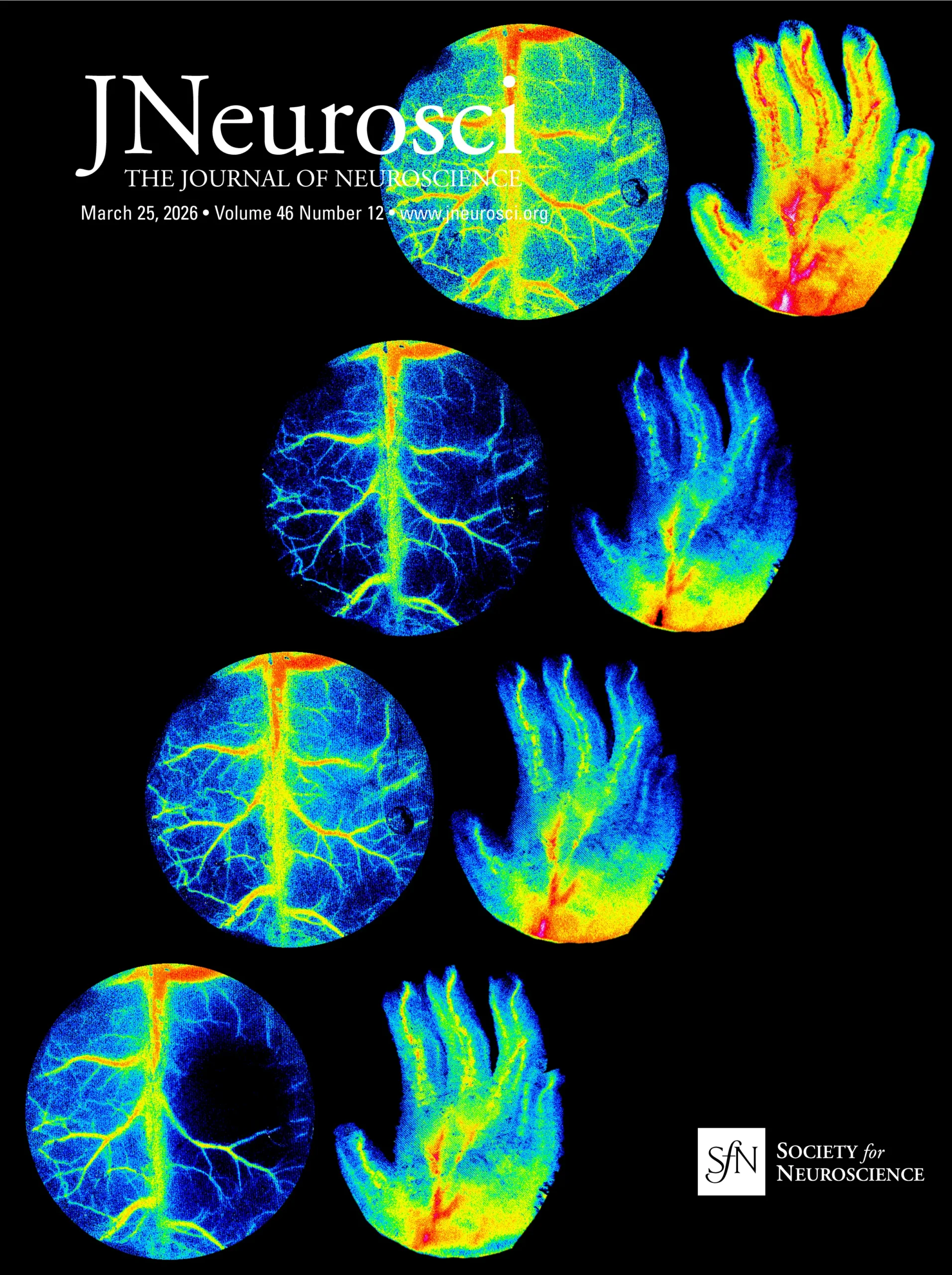 Highlighted Citation: Hemodynamic and Electrophysiological Progression ...